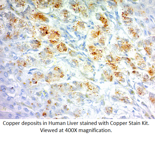 Copper Stain Kit - CSK-2 ( Histology, Special Stains)