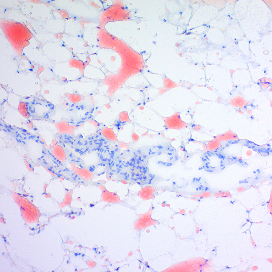 Oil Red O Solution - ORG125 ( Histology, Special Stains)