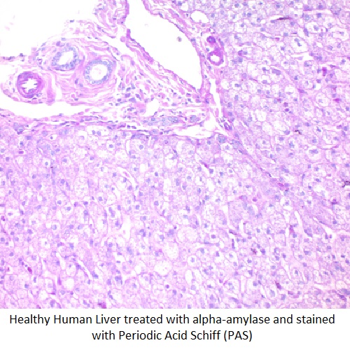 Periodic Acid Schiff (PAS) Diastase Stain Kit