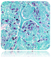 894 Periodic Acid Schiff (PAS) for Fungus Stain Kit - PASF-2 ...