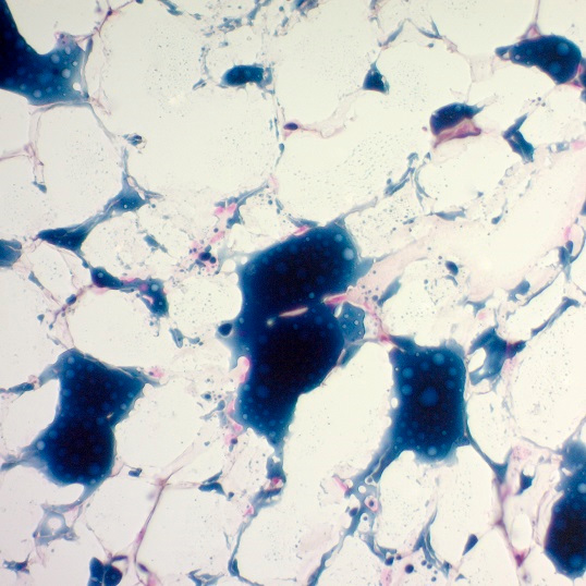 SBK-1 | Sudan Black B Stain Kit (For Fat) Clinisciences