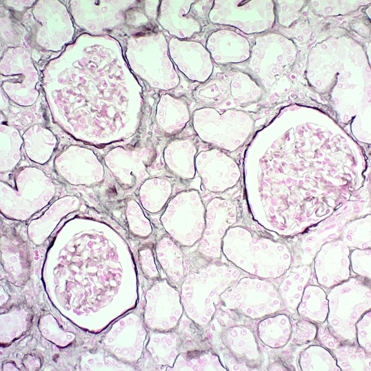 Quick-Dip Differential Stain Kit: press release