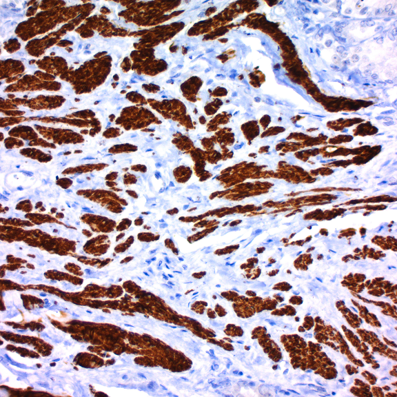 Quick-Dip Differential Stain Kit: press release